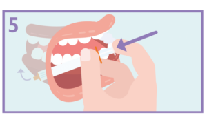 Administering BUCCOLAM® - Buccolam UK